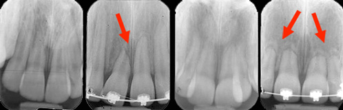 Risques et limitations en orthodontie